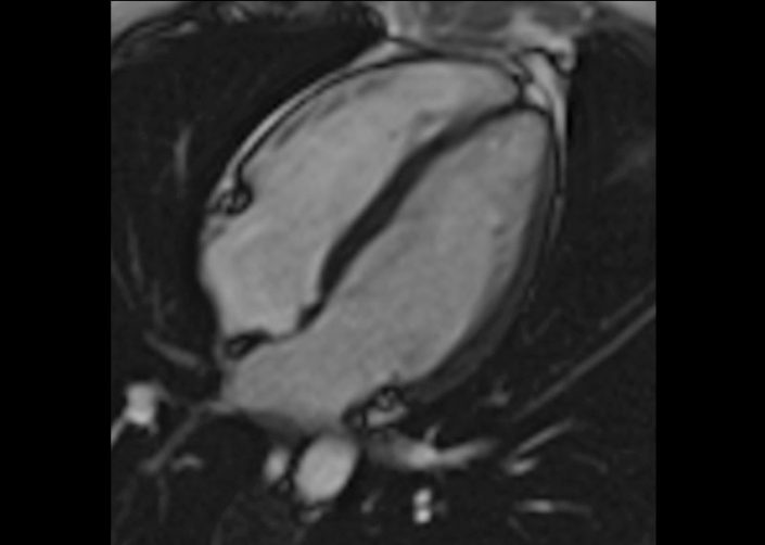 Radiologie & MRT Hamburg – professionelle Betreuung von Anfang an
